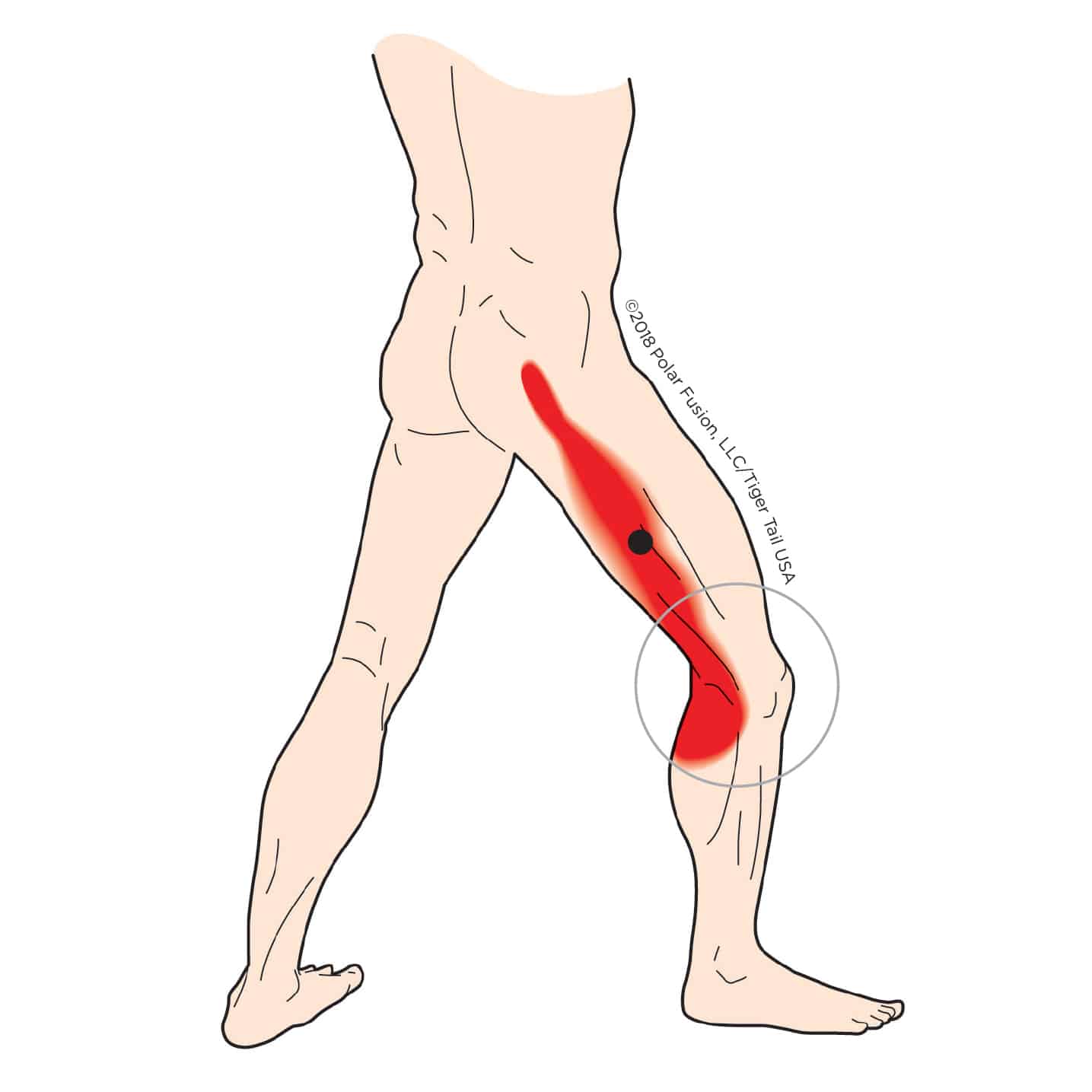 Knee and calf pain store